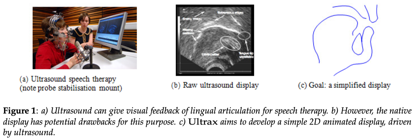 Ultrax: Vocal Tract Imaging for Speech Therapy and Research-LingLab